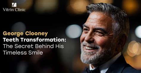 George Clooney Teeth Smile Beauty Guide Vitrin Clinic