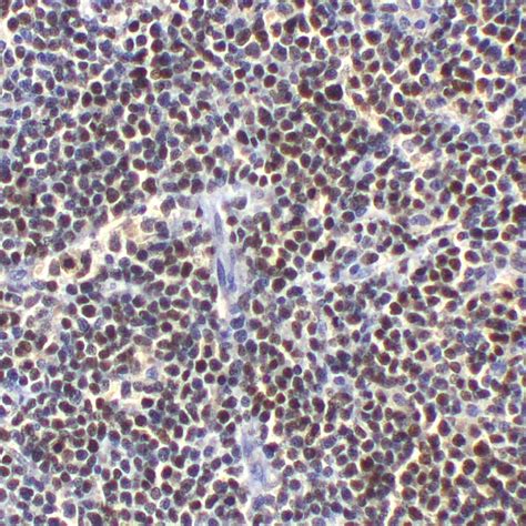 Sox11 Cl0142 Pathnsitu Biotechnologies