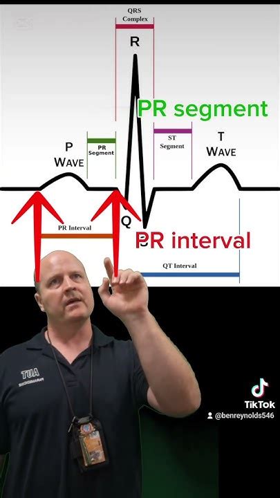 Ecg Basics What Is The Difference Between The Pr Interval And The Pr
