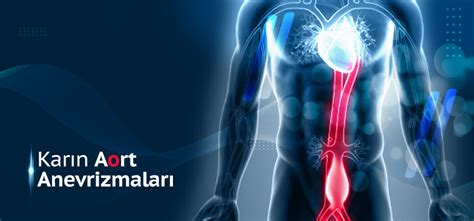 Karın Aort Anevrizmaları Vascular Solutions Clinic