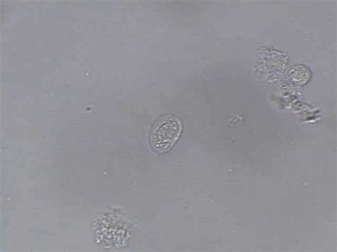Urinalysis Case Simulator Labce