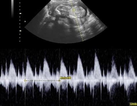 Difference Between 2d 3d 4d Andhd Hd5d Ultrasounds