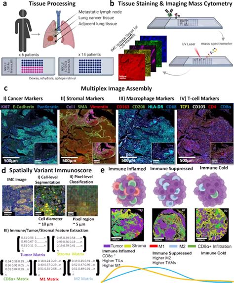 Spatially Variant Immune Infiltration Scoring In Human Cancer Tissues