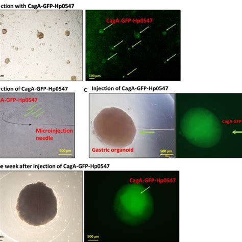 Comparative Infection And Microinjection Of H Pylori Into Human