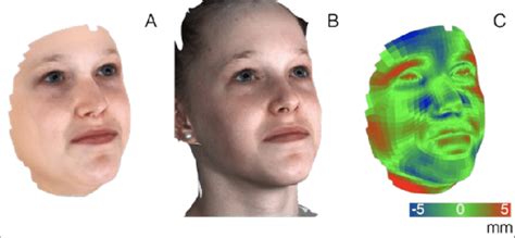 A Comparison Of Using Photo Reconstruction Techniques To A 3dmd Model Download Scientific