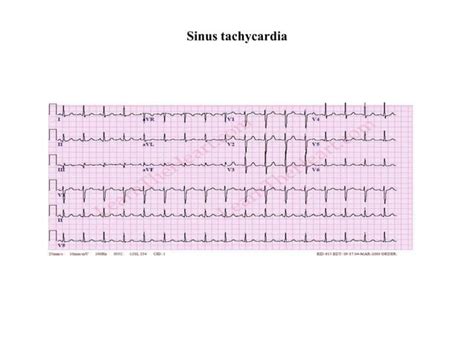 Osce Instruments And Ecg Medicine Pptx