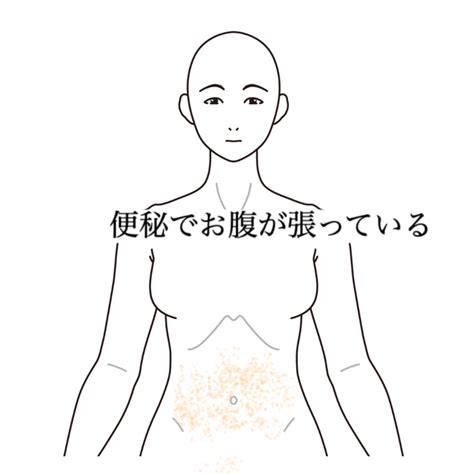 便秘と下痢が混在するお腹の張りと腰痛の改善例｜便秘のツボ｜ツボネット 鍼灸の症例が検索できるツボ辞典