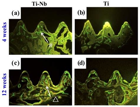 Histotomy Of Bone Contact Of The Ti Nb Alloy Ac And Ti Bd At 4