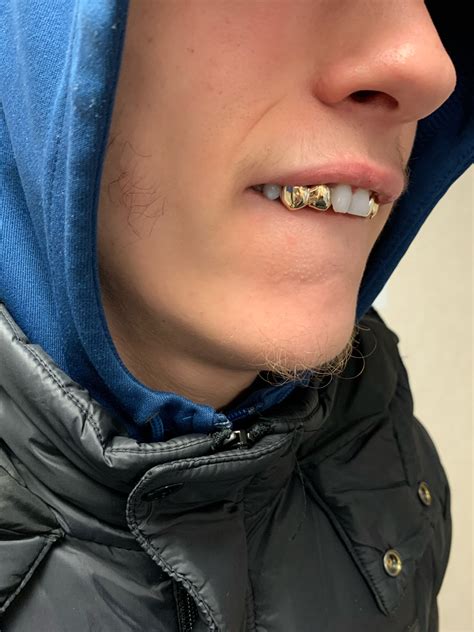 Gold Tooth Cap