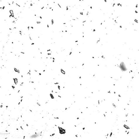 Automated Particle Size Count Analysis At Best Price In Pune