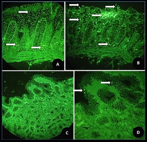 Indirect Immunofluorescence Detection Of Norovirus Capsid Protein Vp1