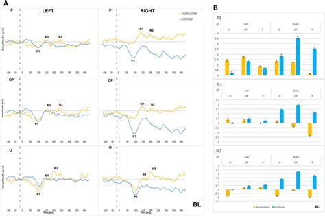 A Grand Average Erp Waveforms In Left And Right Parietal P Top