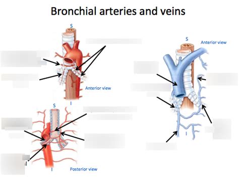 Bronchial Artery