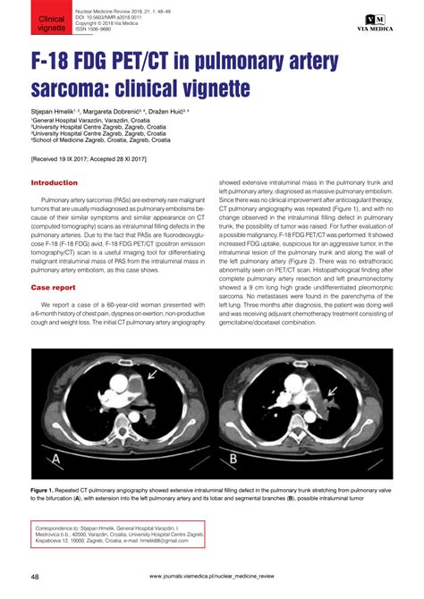 Pdf F 18 Fdg Petct In Pulmonary Artery Sarcoma Clinical Vignette