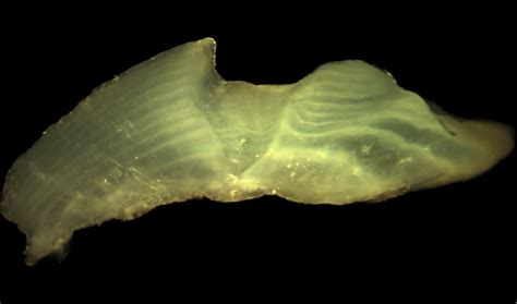Example Image Of A Transverse Sectioned Sagittal Otolith Used To
