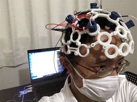 Unstable Bluetooth Connection And How To Avoid Openbci Forum