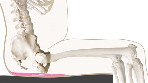 Wound Care How To Fight Shear