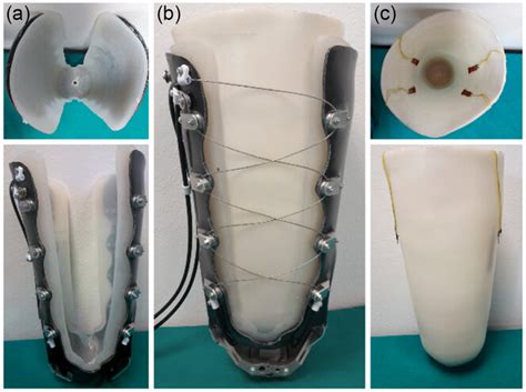 Smart Transfemoral Prosthetic Socket With Motorized Cable‐driven System Paternò Advanced