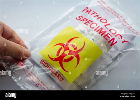 Close Up Of A Person Collecting A Pathology Lab Specimen Package Stock