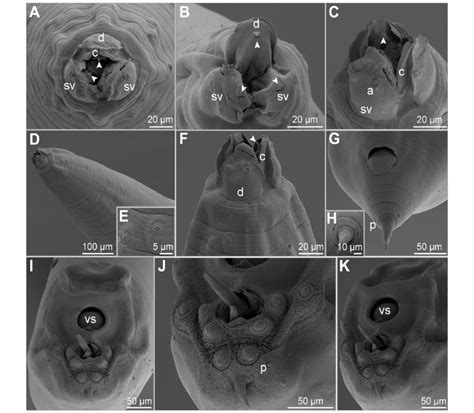 Strongyluris Oscari Travassos 1923 Scanning Electron Micrographs