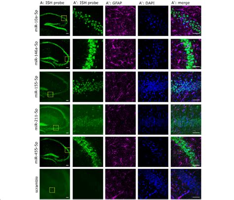 Deregulated Mirnas Are Expressed In Neurons Fluorescent In Situ