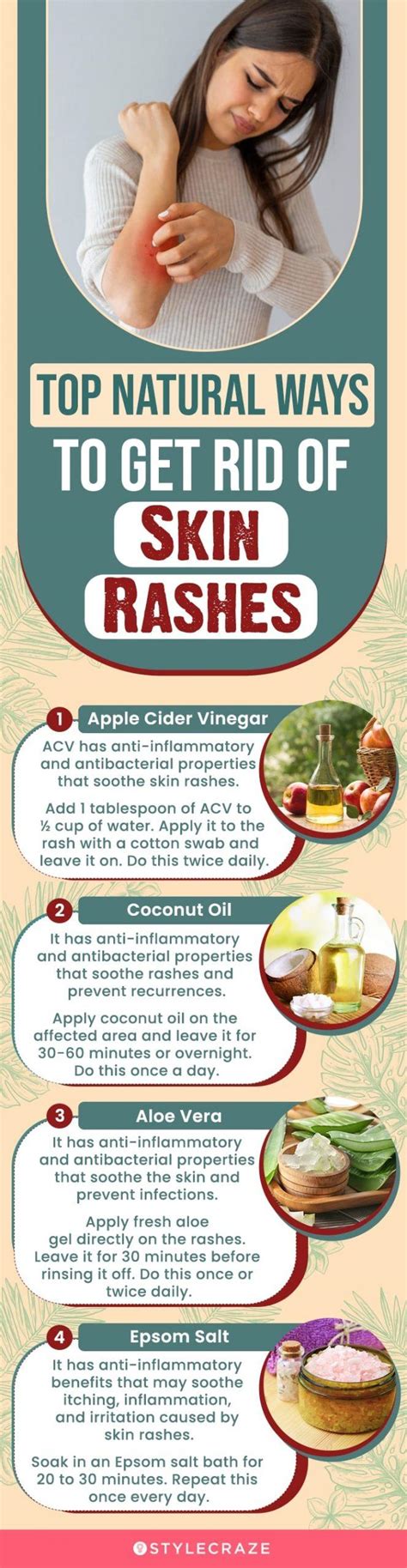 How To Get Rid Of Rashes Easy Home Remedies And Tips
