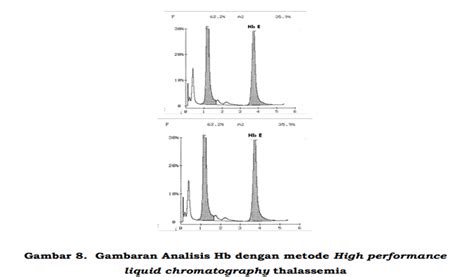 Pemeriksaan Laboratorium Dalam Mendiagnosa Thalassemia