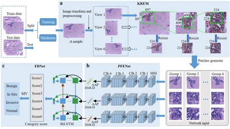 使用 Msmv Pfenet 对乳腺癌组织学图像进行分类scientific Reports X Mol