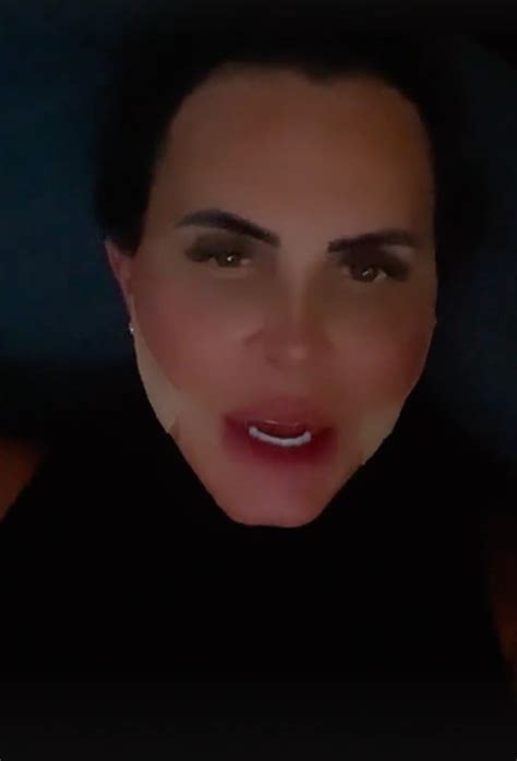 Depois da cirurgia de retirada do útero Gretchen fala sobre recuperação Estou bem melhor mas
