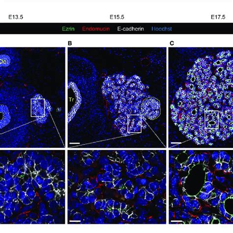 Visualisation Of The Developing Thyroid At Three Different Embryonic