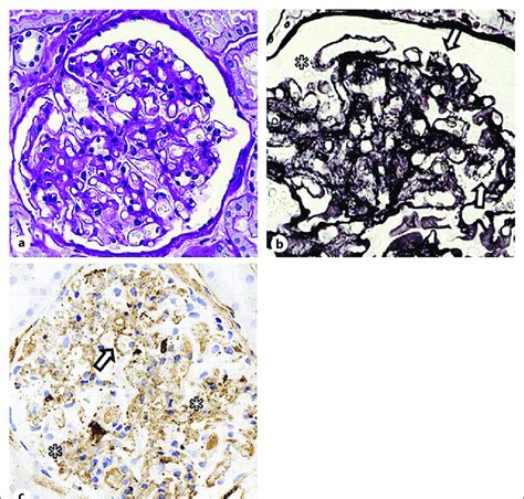 Light Microscopic Findings A Periodic Acid Schiff Staining Original