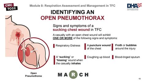 Respiration Assessment And Management In Tfc