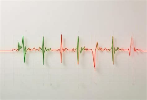 3d Ecg Line Mockup Template For Cardiology And Medical Presentations Premium Ai Generated Image