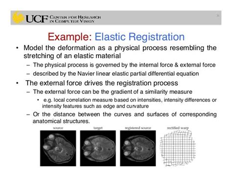 Lec16 Medical Image Registration Advanced Deformable Registration