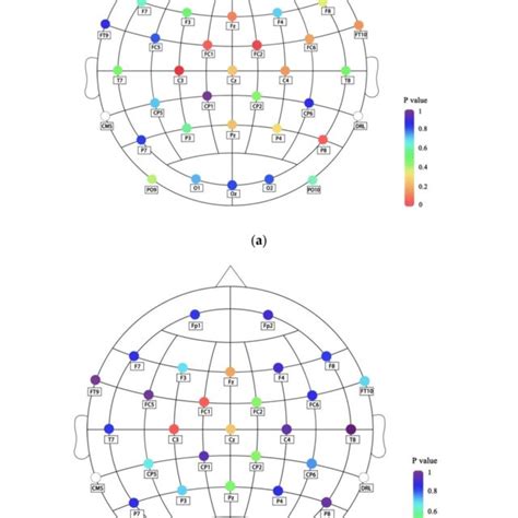 Significant Brain Dot Distribution A δ Band And B β Band