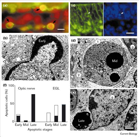 Figure From Differences Between The Clearance Of Apoptotic Cells By Professional And Non