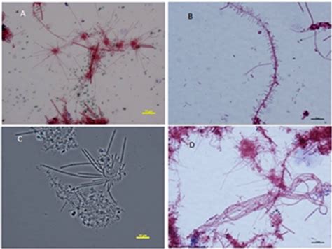 In Situ Identification Of Filamentous Bacteria From Activated Sludge Wastewater Treatment Plants