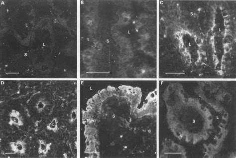 A Pepsin Trypsin Digest Ofgliadin Was Instillated In Thejejunum In