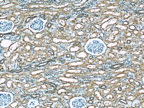 Keap1 Antibody 60027 1 Ig Proteintech