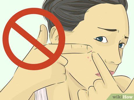 3 Ways To Clear Under The Skin Pimples WikiHow Health
