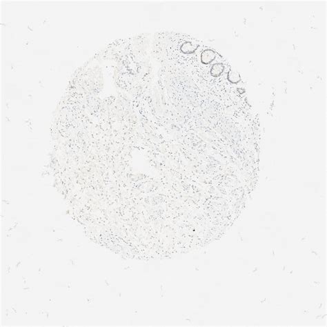 Bad Segmentation With Large IHC Images Issue 26 Nadeemlab DeepLIIF