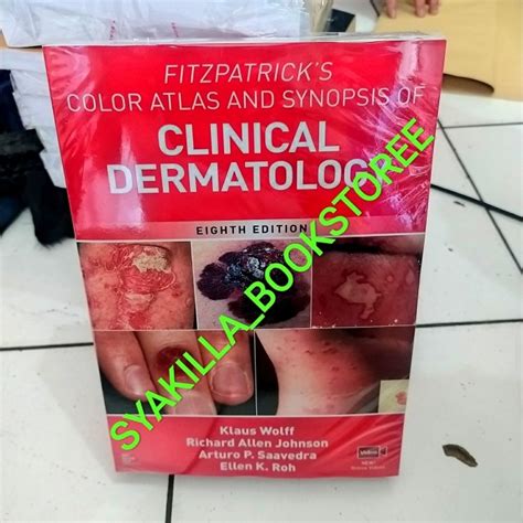 Jual Fitzpatricks Color Atlas And Synopsis Of Clinical Dermatology