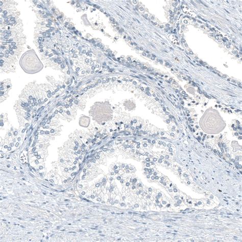 Mouse Monoclonal Anti Ager Antibody Buy For Research Highly