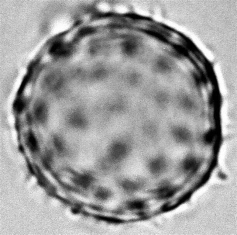 花粉写真図版 Pollen photograph plate