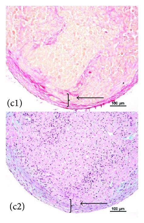 Extracellular Matrix Production Histology Of The Hds Stained With Download Scientific Diagram