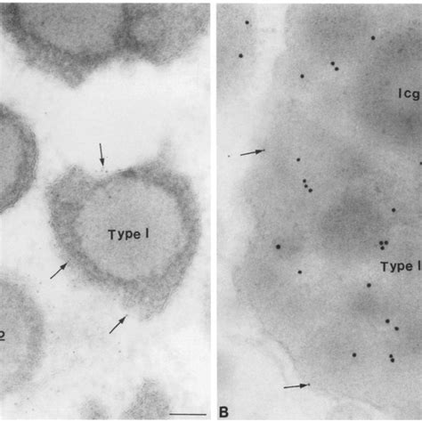 Double Immunogold Labeling For The Lysosomal Marker Lgpl20 5 Nm