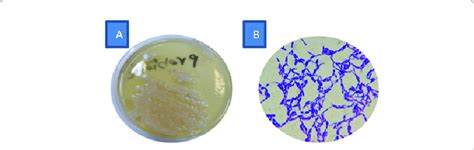 Isolation And Identification Of Lactobacillus Species A Download Scientific Diagram