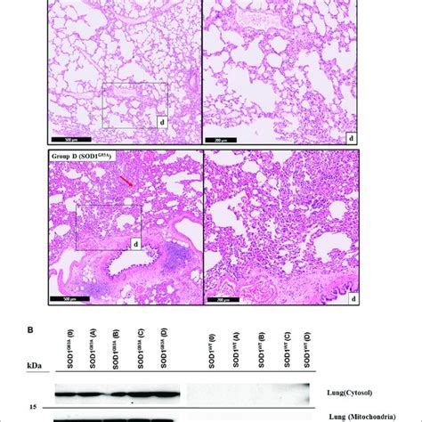 Hande Stained Lung Tissue Sections Of Lung Tissues Representative