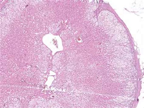 Ectopic Adrenal Cortex Hande X100 Download Scientific Diagram