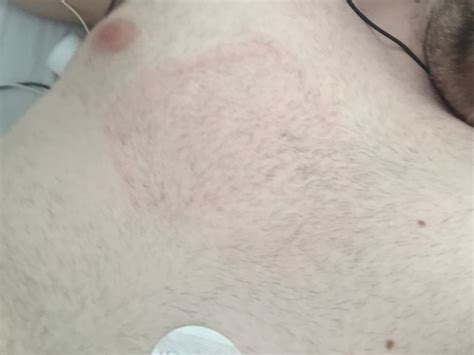 Male Resus On Tumblr